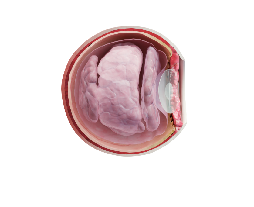 Ophthalmology Videos, Images & 3D Animations | Voka Shop